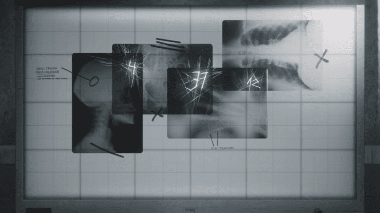 Silent Hill 2 Remake: X-Ray Puzzle Solution & Combination Lock Code